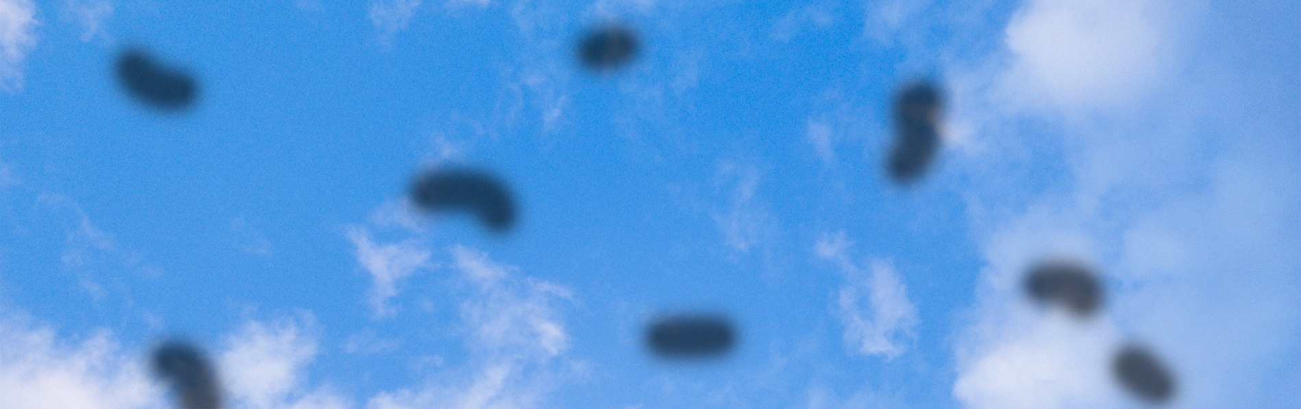 The facts about eye floaters - Patrick & Menzies